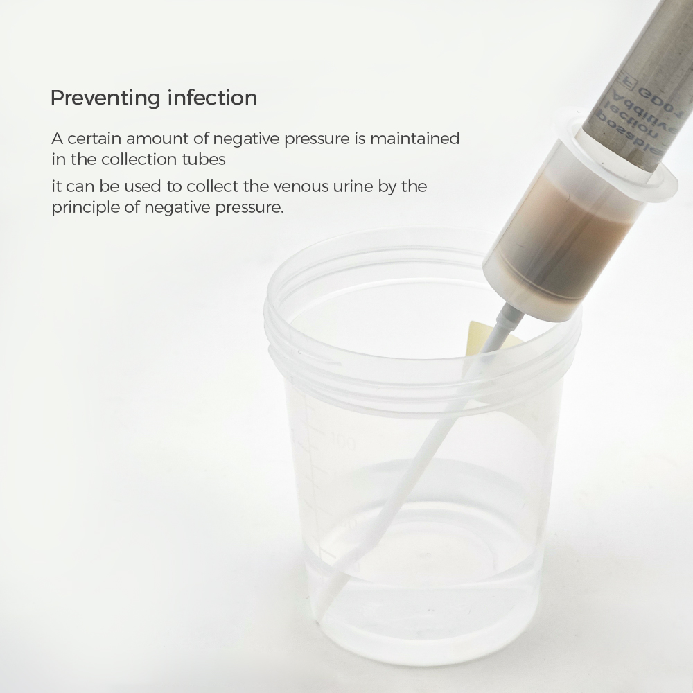 Vacuum Urine Tube | KDLNC