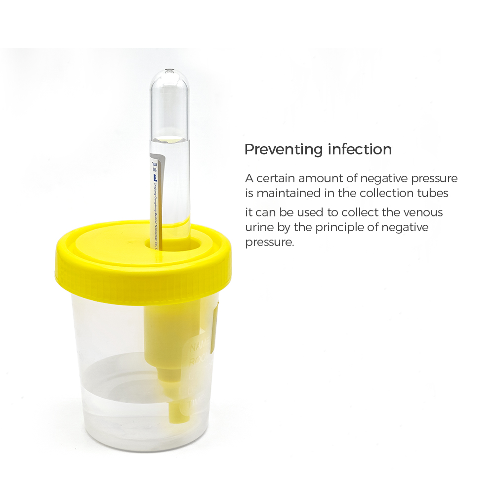 Vacuum Urine Container | KDLNC