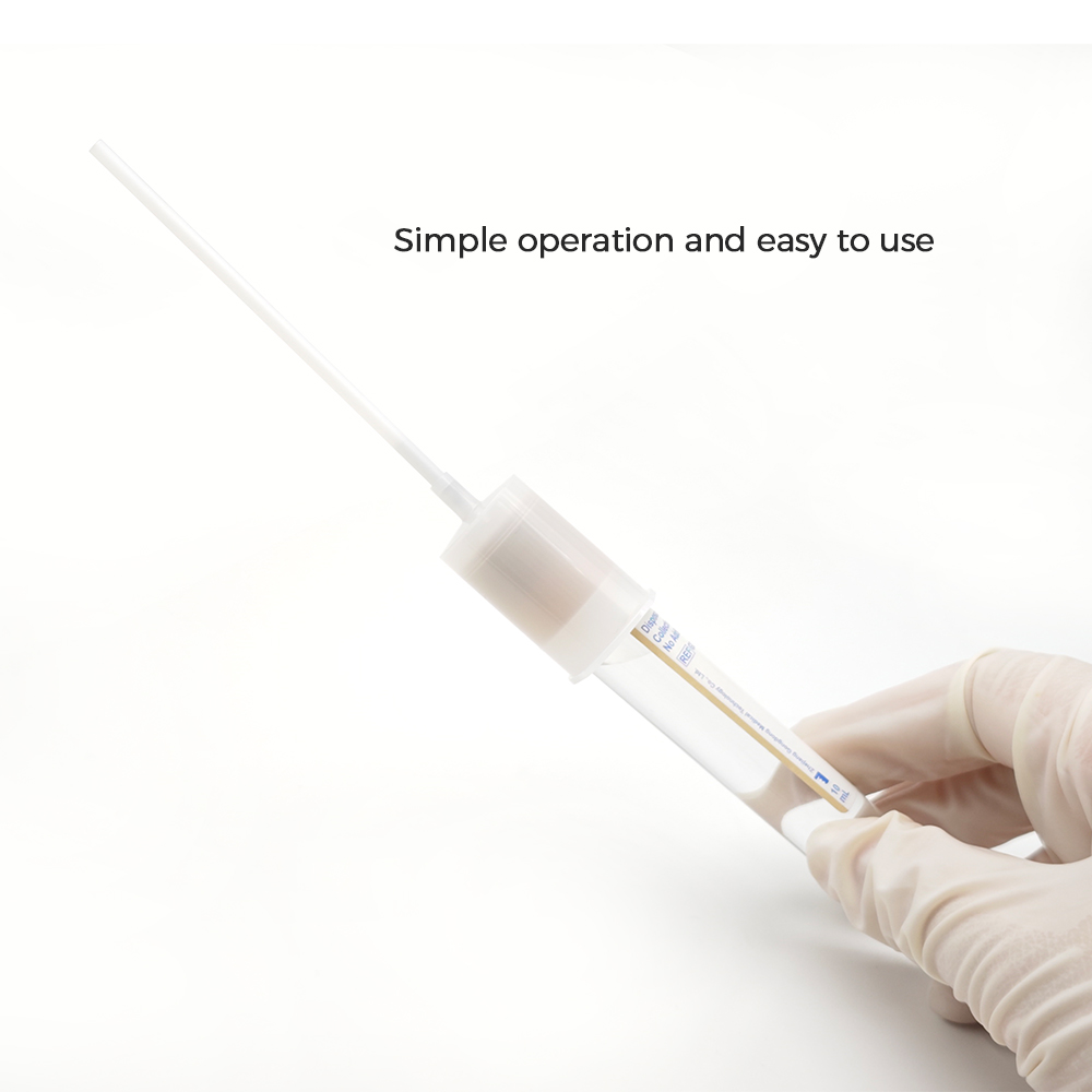 Vacuum Urine Tube | KDLNC