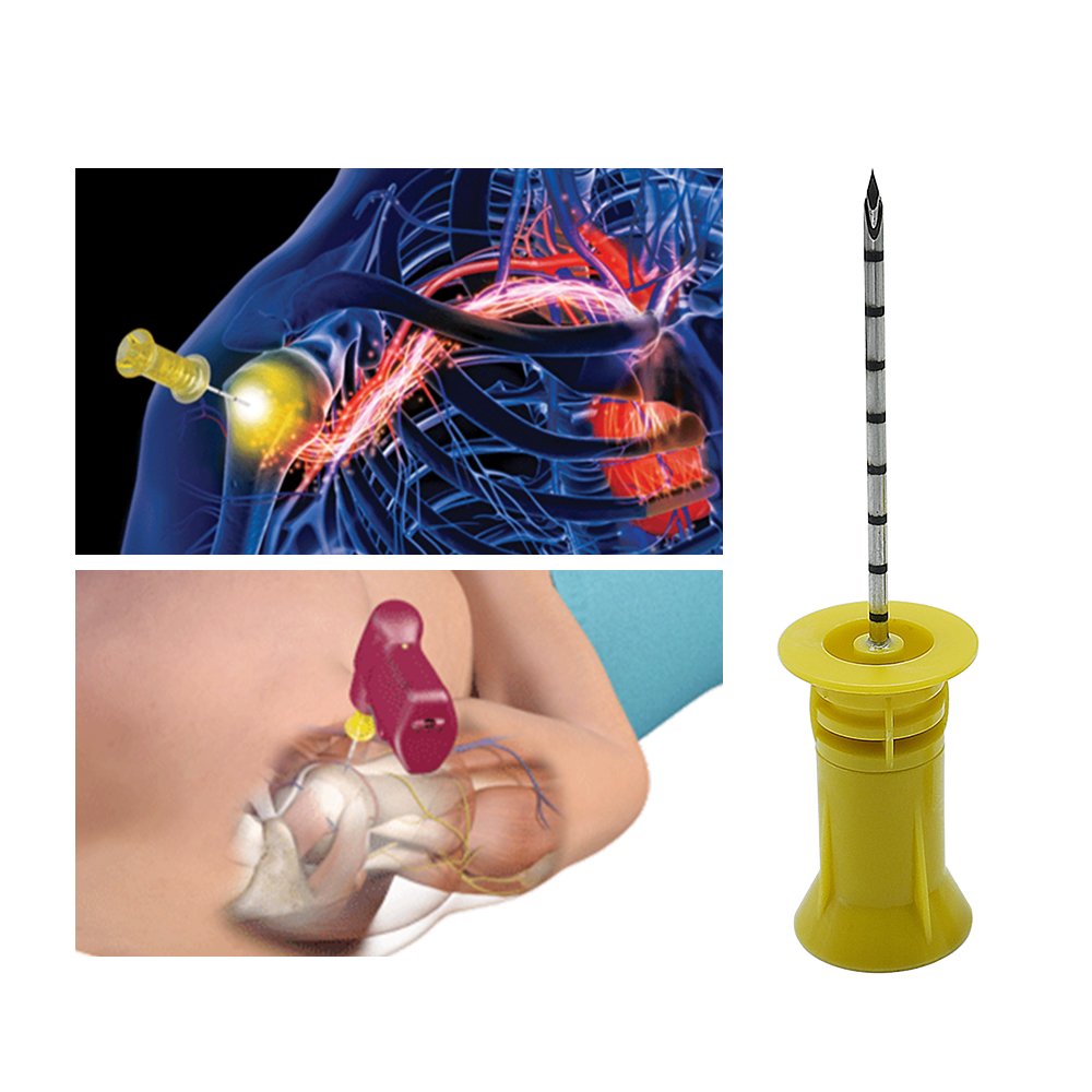 Disposable Bone Marrow Infusion Sets For Single Use - KDL