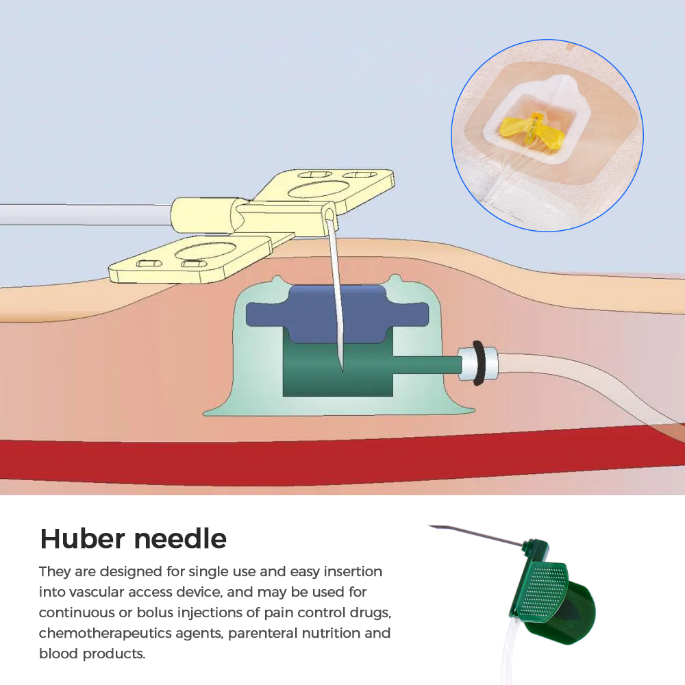 KDL Disposable Huber Needle (Y Type) - KDL
